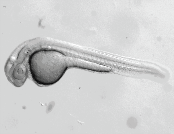 Research | Brumell Lab | SickKids