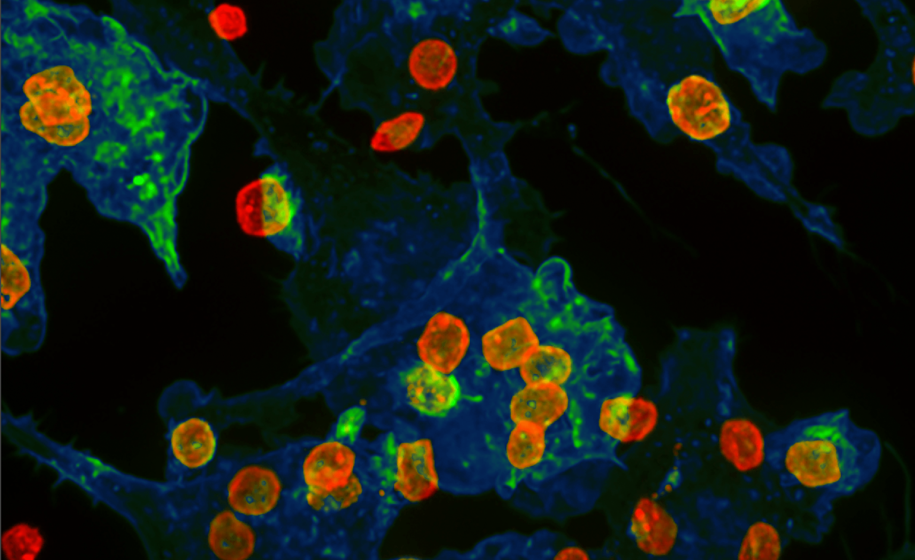 Publications | Spencer Freeman Lab | SickKids