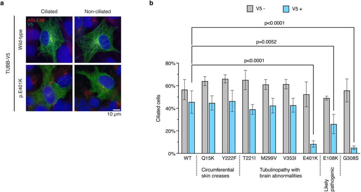 Projects | The Ivakine Lab | SickKids