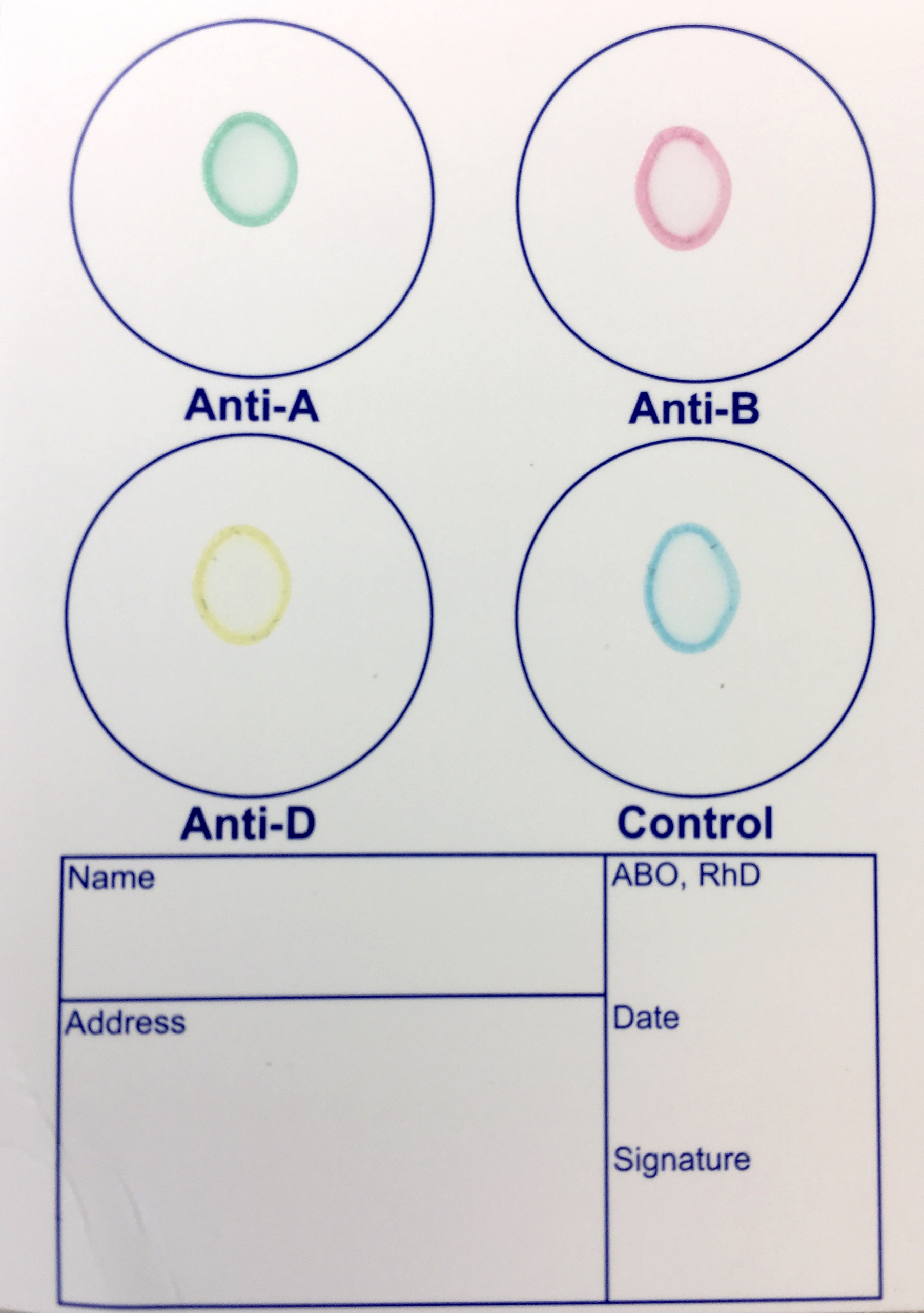 Prevention of Rhesus (Rh) Disease of Newborns in Pakistan - The Morris Lab