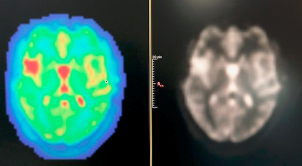 Research MRI Core Facility | SickKids