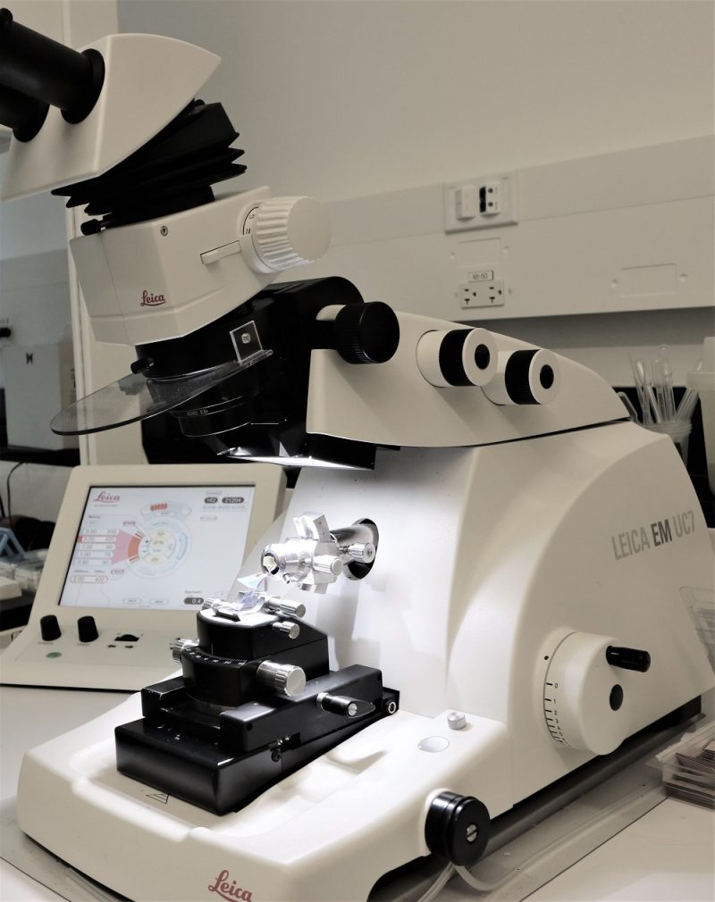 Cellular and Molecular Electron Microscopy | SickKids NBIF