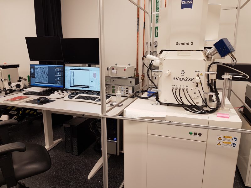 3D Scanning Electron Microscopy | SickKids NBIF