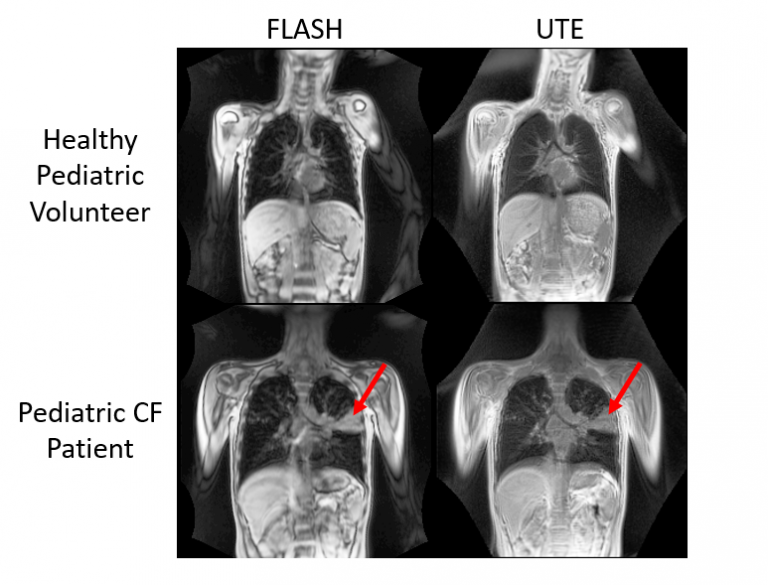 Proton MRI – Santyr Lab