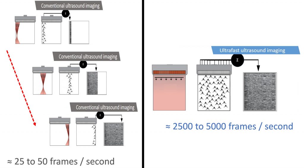 Ultrafast Ultrasound Imaging - Villemain Lab